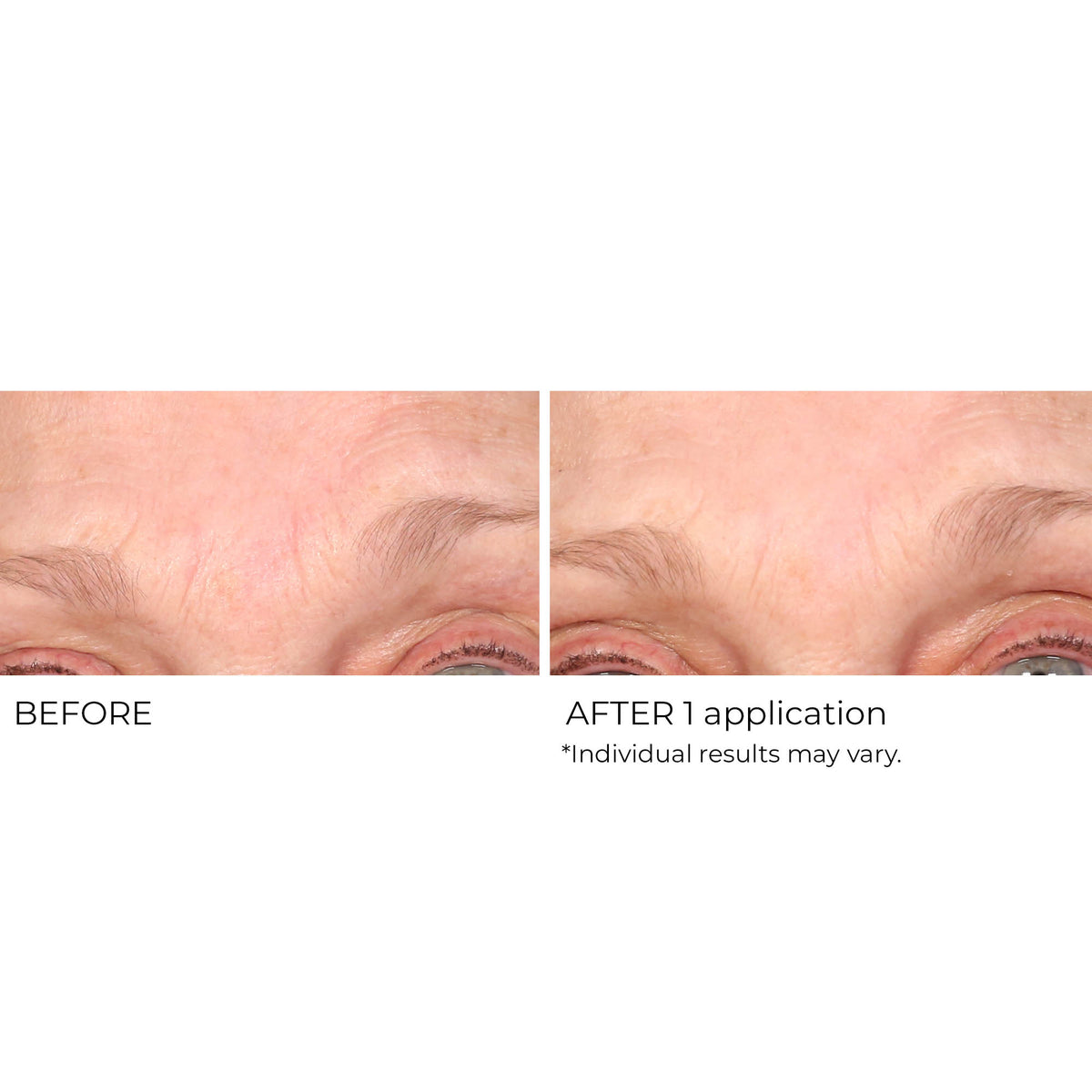 Wrinkle Blur Targeted Treatment – Revelo Cosmetics